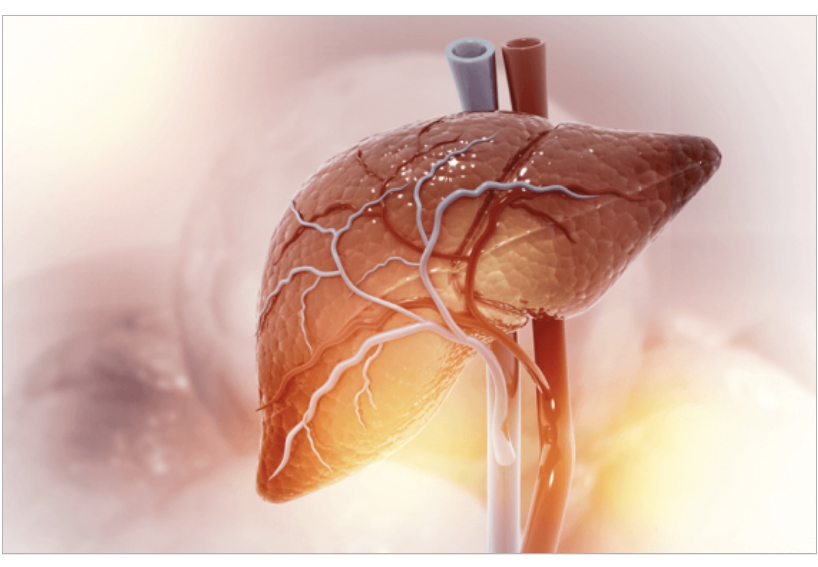 Une piste prometteuse pour le traitement de la MASH ! - Fondation ...